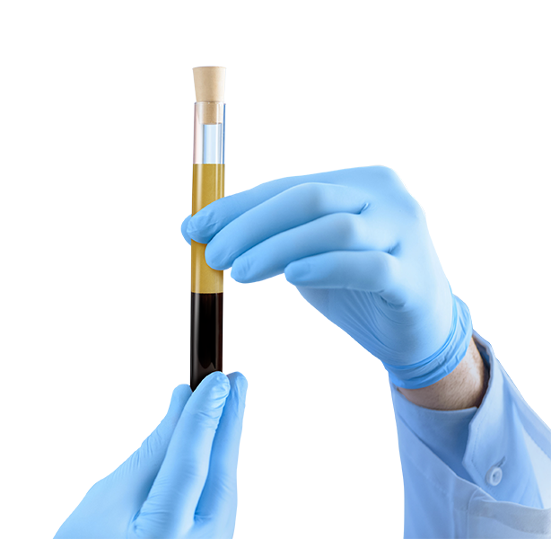 Jacobi Resins | Ion Exchange Resins | Industry Leading Provider